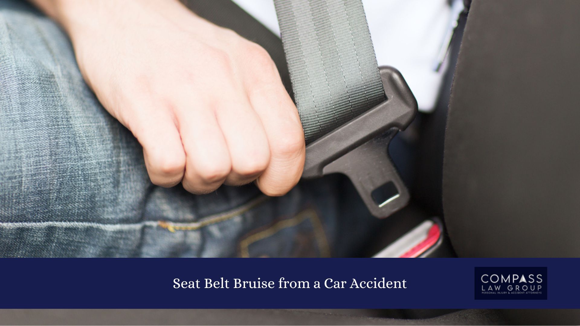 Seat Belt Bruises from a Car Accident